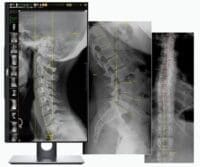 20/20 Imaging Opal-Chiro PACS - RPS Imaging